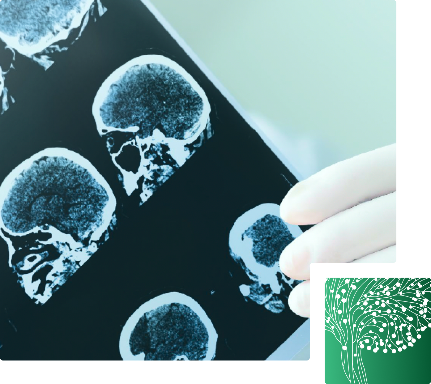 PPMI - Aligning Science Across Parkinson's